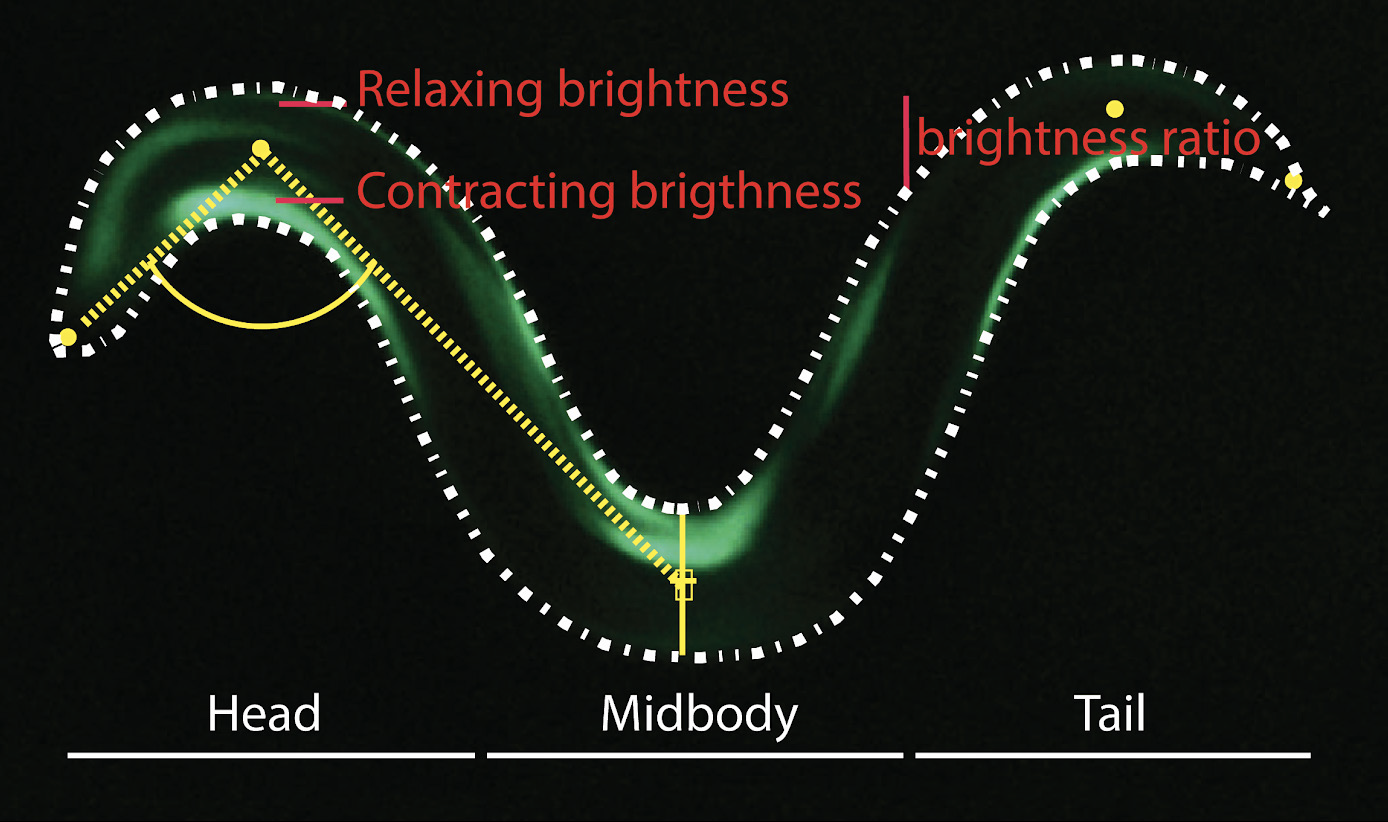 Muscular activity makes Duchenne muscular dystrophy worse in a worm ...